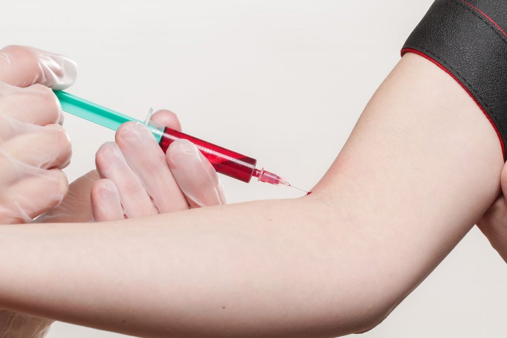 Decouvrez les normes sur la prise de sang: coagulation, hemostase